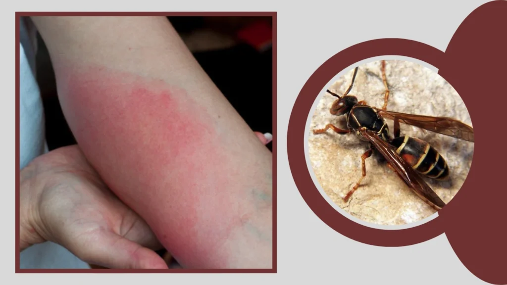 Are Paper Wasps Dangerous? Risks, Stings, and Safety