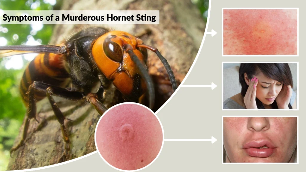 Murderous Hornets Sting Symptoms Reaction And Treatment