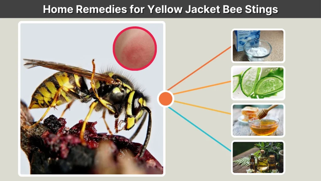 Yellow Jacket Bee Stings: Symptoms, Pain, and First Aid