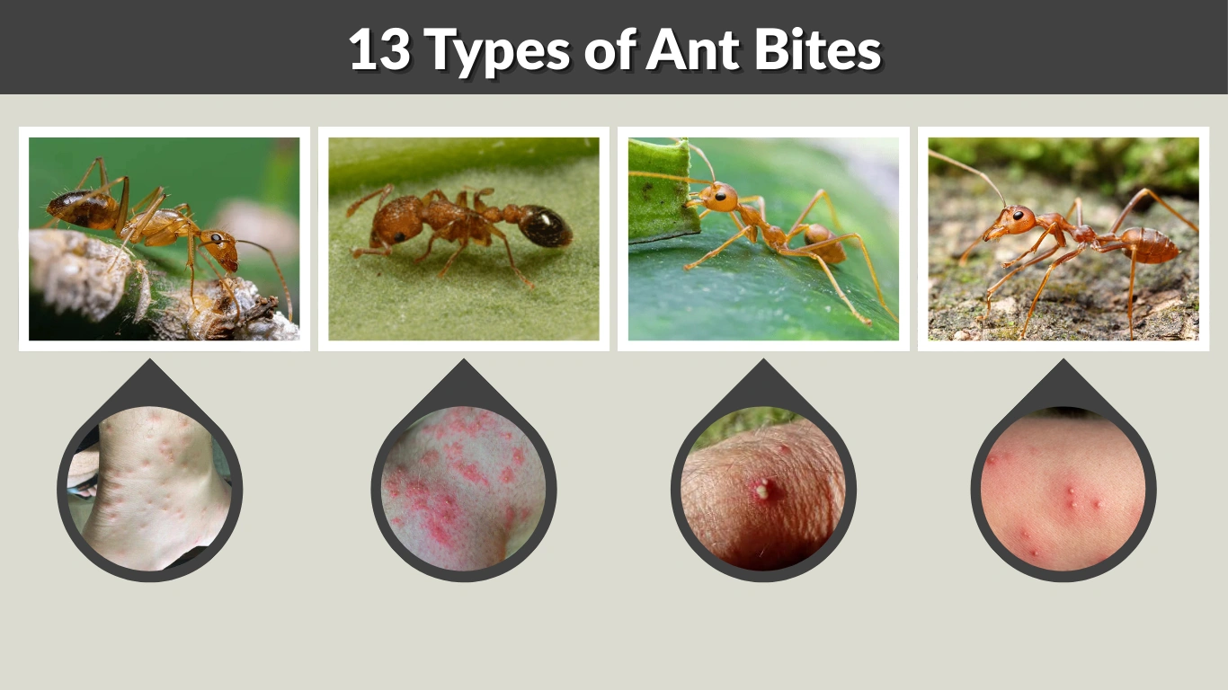 13 Types of Ant Bites: Symptoms, Reaction, Identification With Pictures