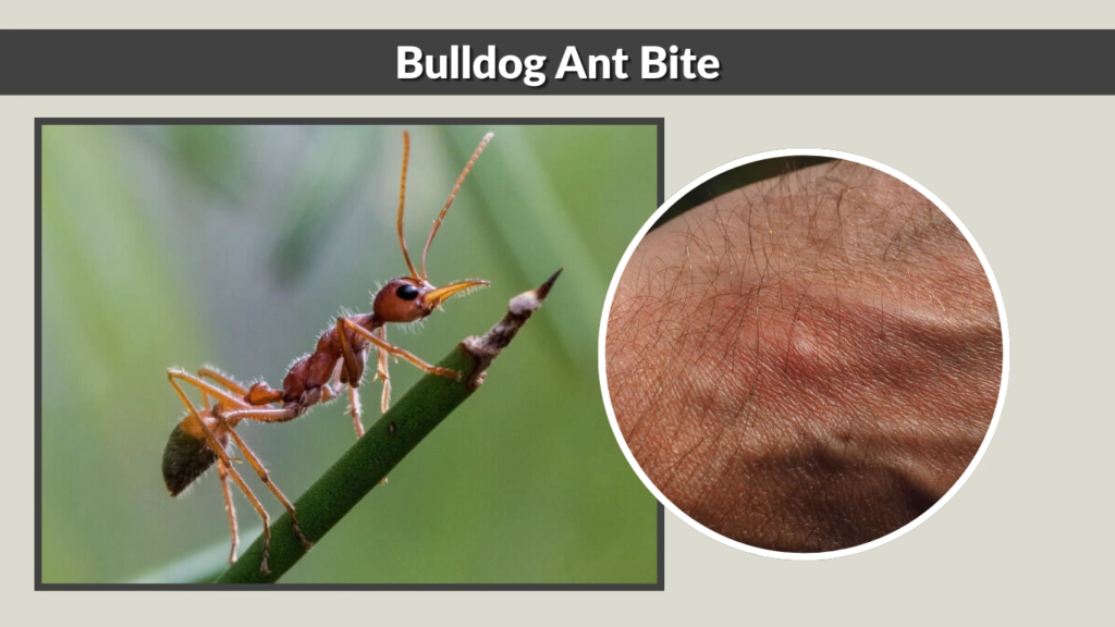 13 Types of Ant Bites: Symptoms, Reaction, Identification With Pictures