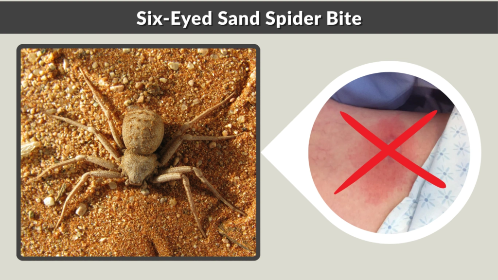 Six-Eyed Sand Spider: Bite, Venom, Size & Facts