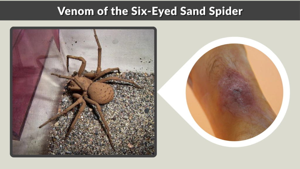 Six-Eyed Sand Spider: Bite, Venom, Size & Facts