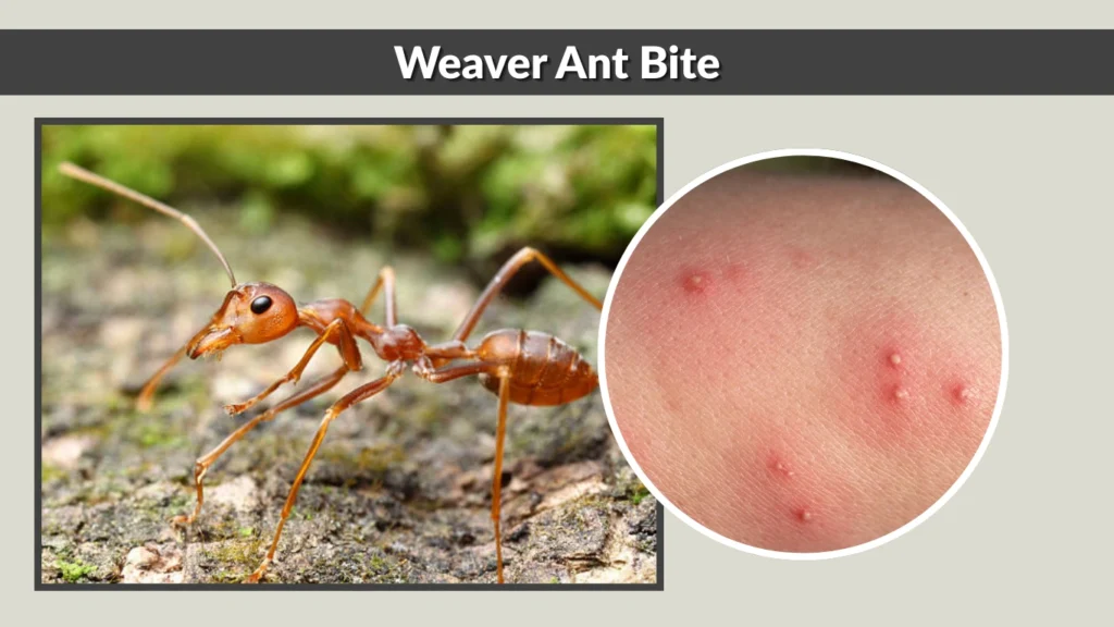 13 Types of Ant Bites: Symptoms, Reaction, Identification With Pictures