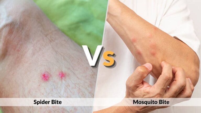 Spider Bite vs Mosquito Bite: Key Differences, Symptoms, and Identification