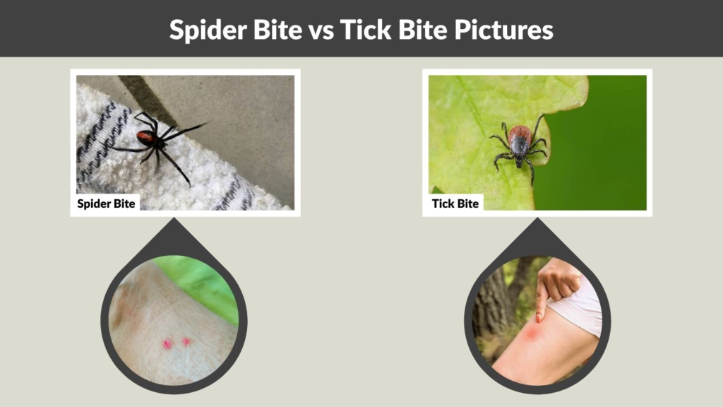 Spider Bite vs Tick Bite: Key Differences, Symptoms & Pictures