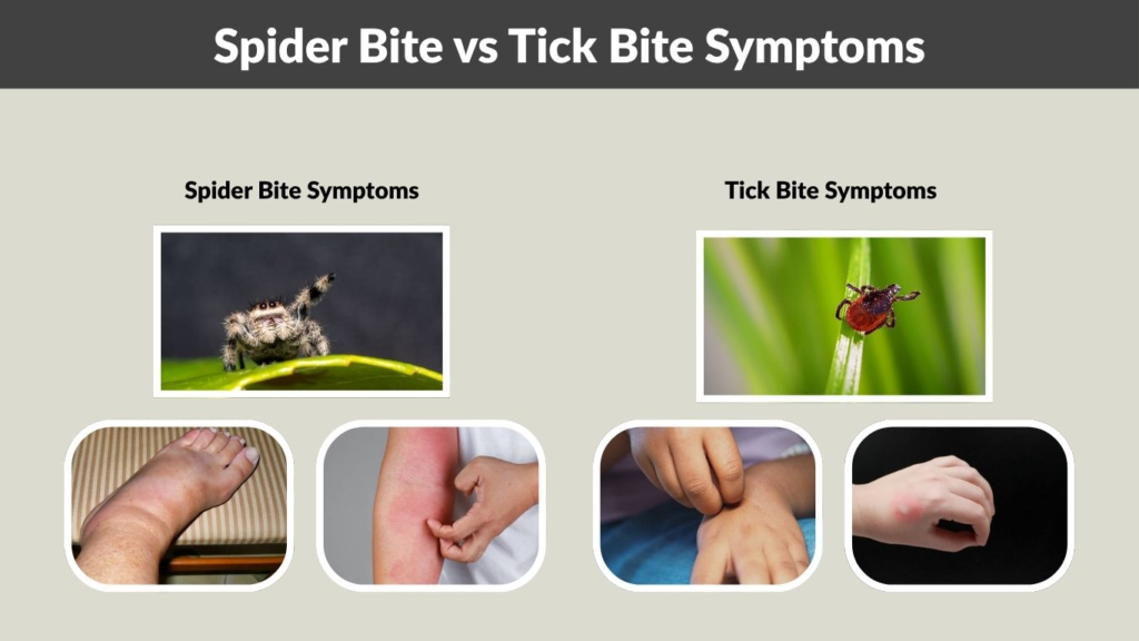 Spider Bite vs Tick Bite: Key Differences, Symptoms & Pictures