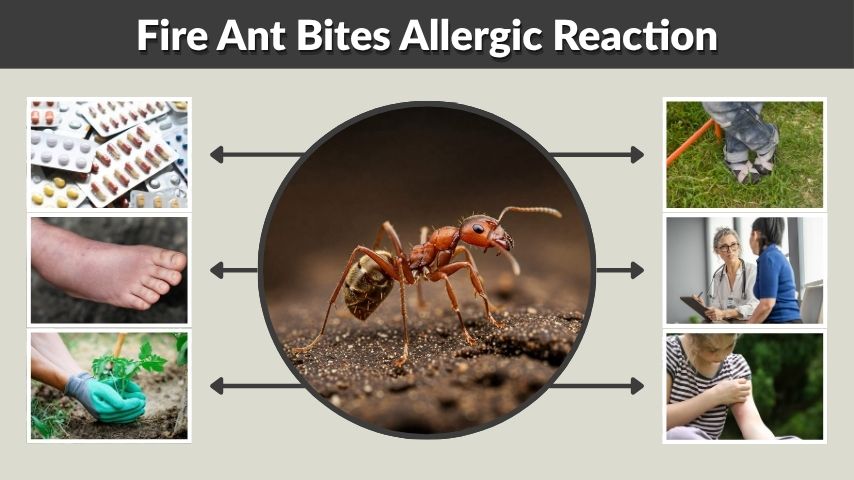 Fire Ant Bites Allergic Reaction: Symptoms and Treatment